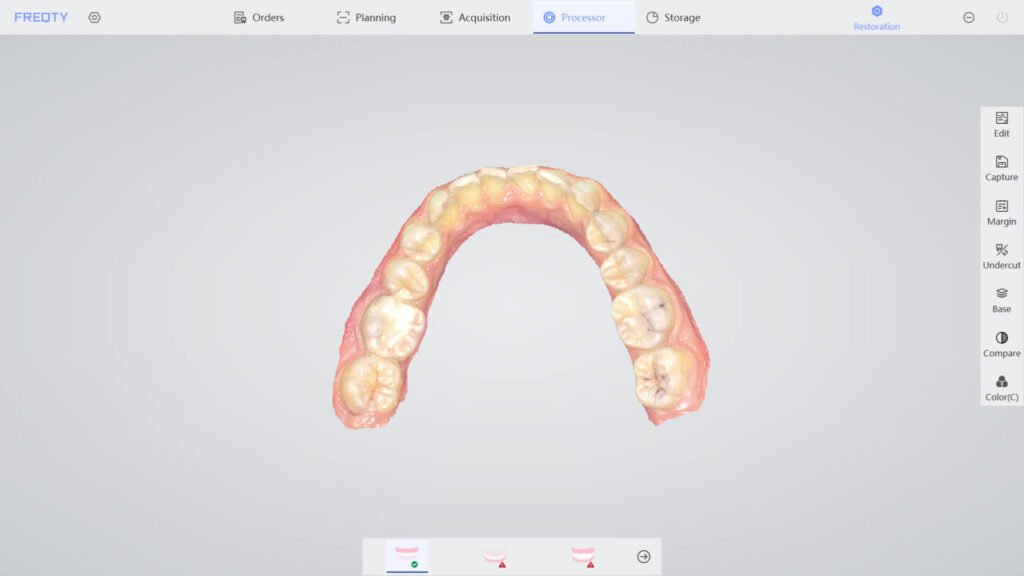 Intraoral Scanner – SC Dental Supply Sdn. Bhd.